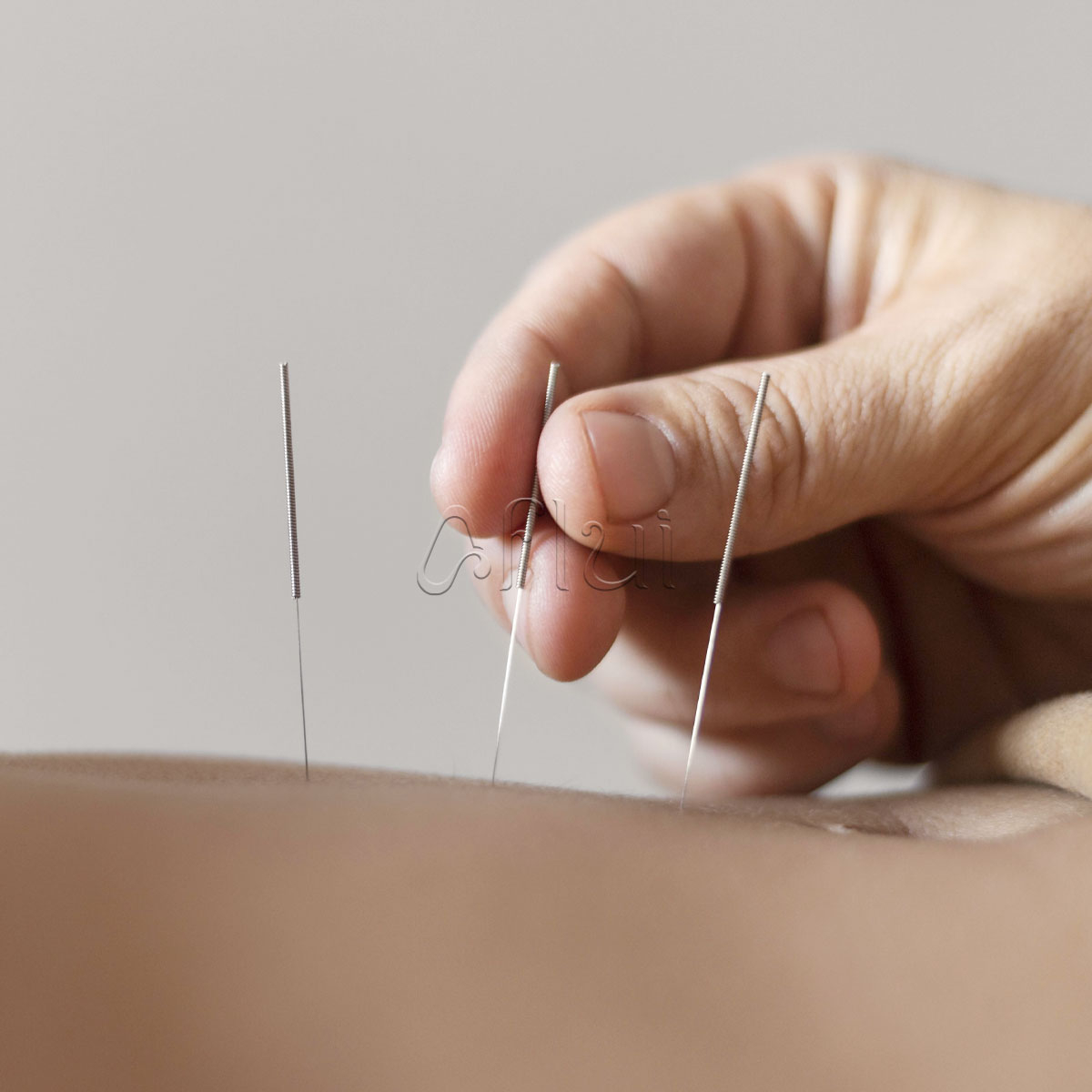 Agulha Acupuntura Sistêmica DUX Safecolor - 500 agulhas