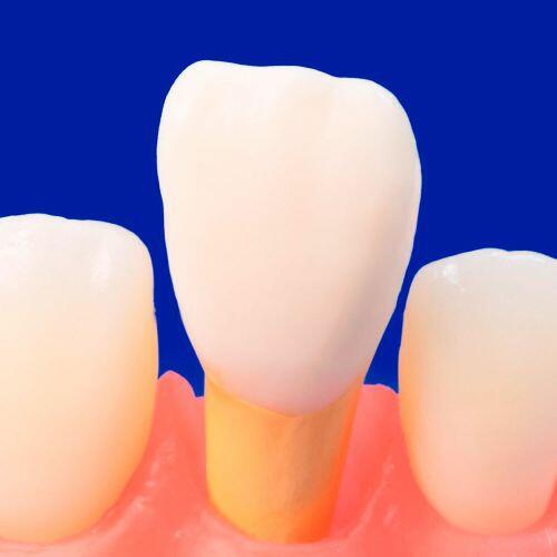 Comprar Dente Diferenciado 11.14 Endo Radiopaco Pronew - a partir de R ...