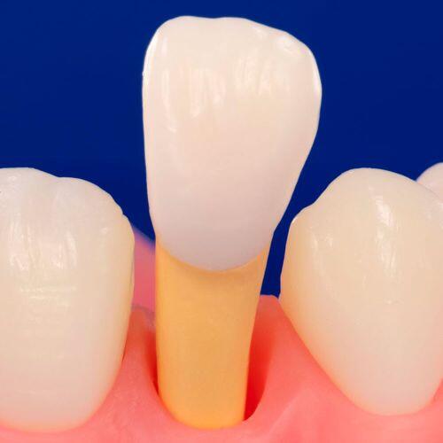 Comprar Dente Diferenciado 12.12 Endo Radiopaco Vestibular Pronew - a ...